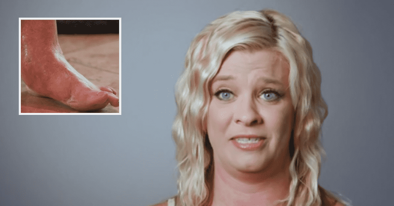 'My Feet Are Killing Me': After 42 surgeries, Heather hopes the next ...