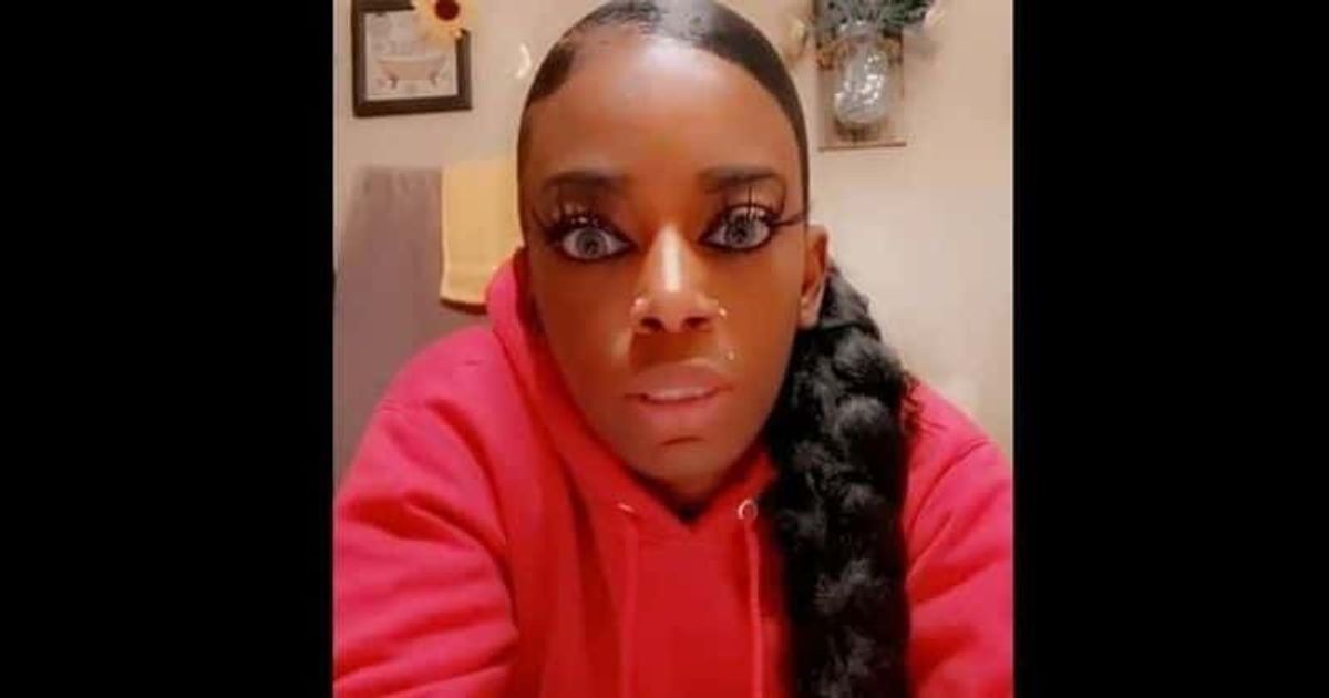 Did 'Gorilla Glue Girl' Tessica Brown get plastic surgery? Doctor finds ...