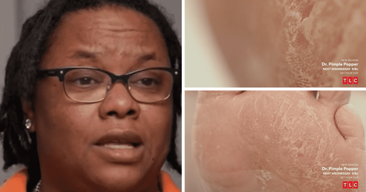 'My Feet Are Killing Me' Season 4: Dr Brad Schaeffer treats chef with ...