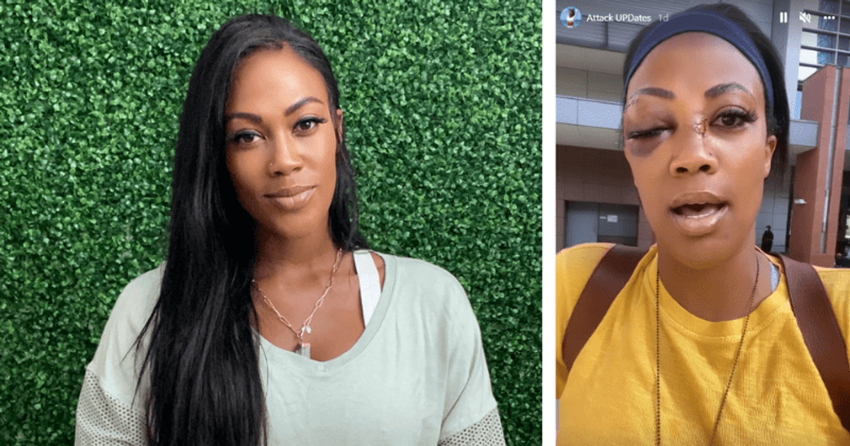 Olympic medalist Kim Glass shares horrifying pics after being attacked ...