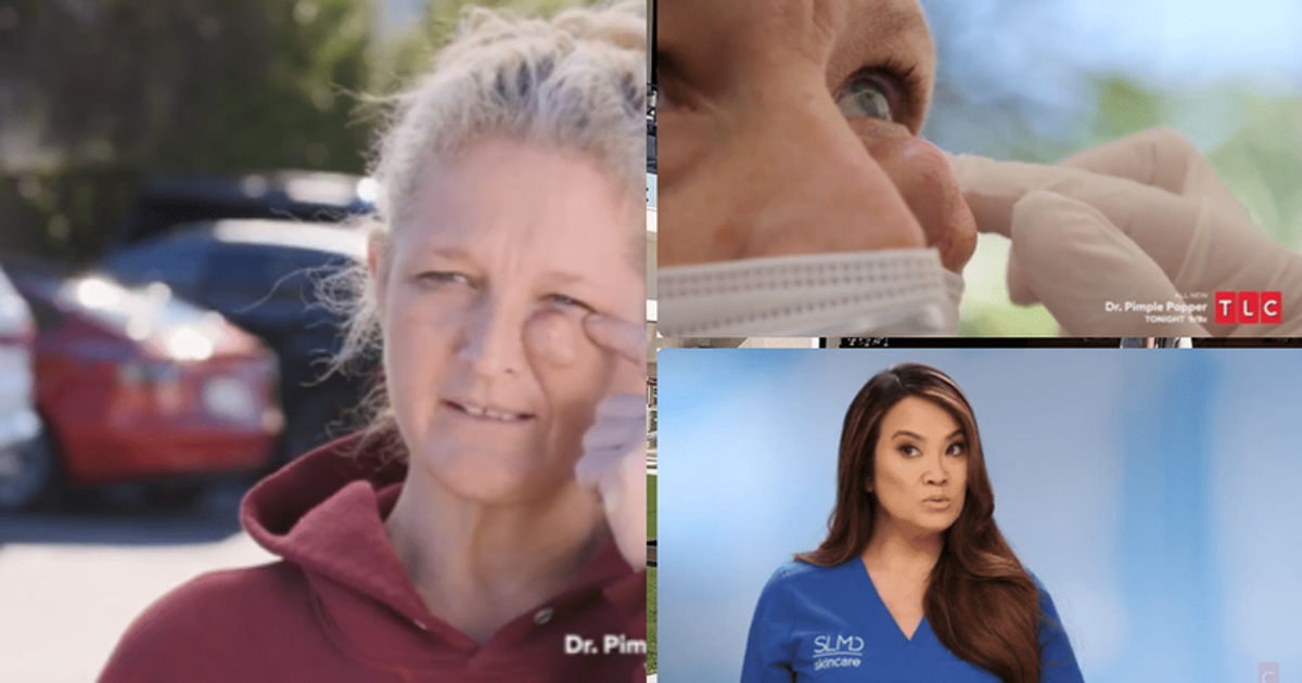 'Dr Pimple Popper' Season 8: Dr Lee apprehensive to help Jessica as her ...