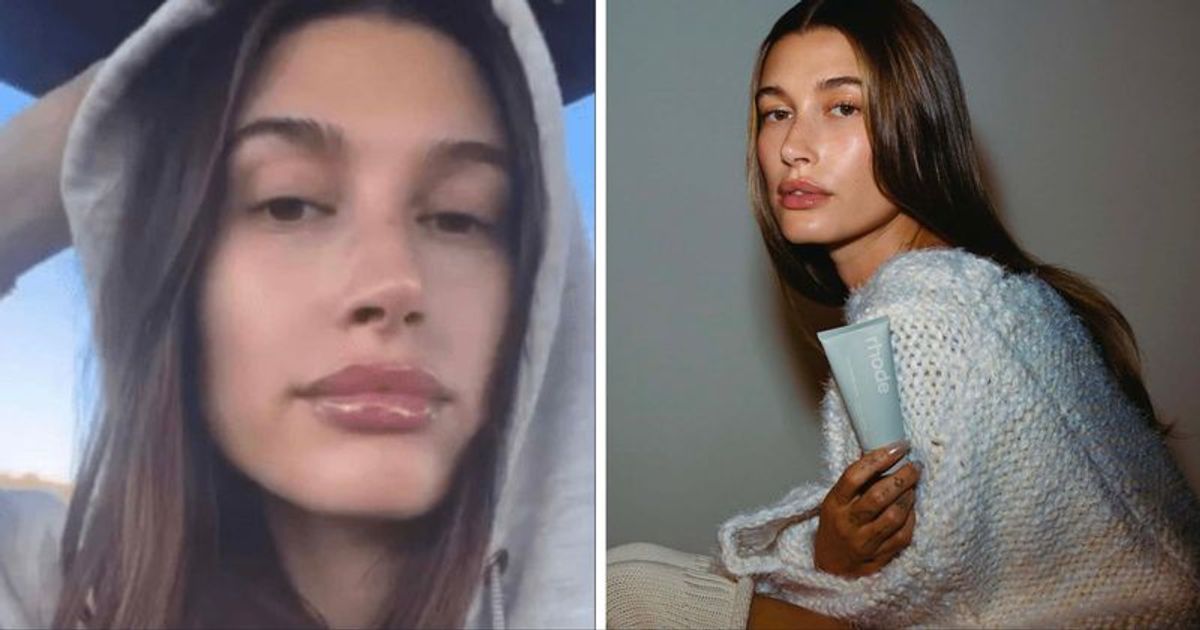 Hailey Bieber flaunts 'natural' plump pout but fans believe she has a ...