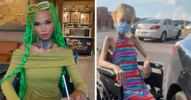 IG model Gena Tew reveals she is blind again after failed eye surgery ...