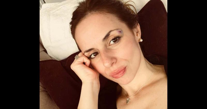 Shocking photo of missing mom Ana Walshe shows cut above her eye ...