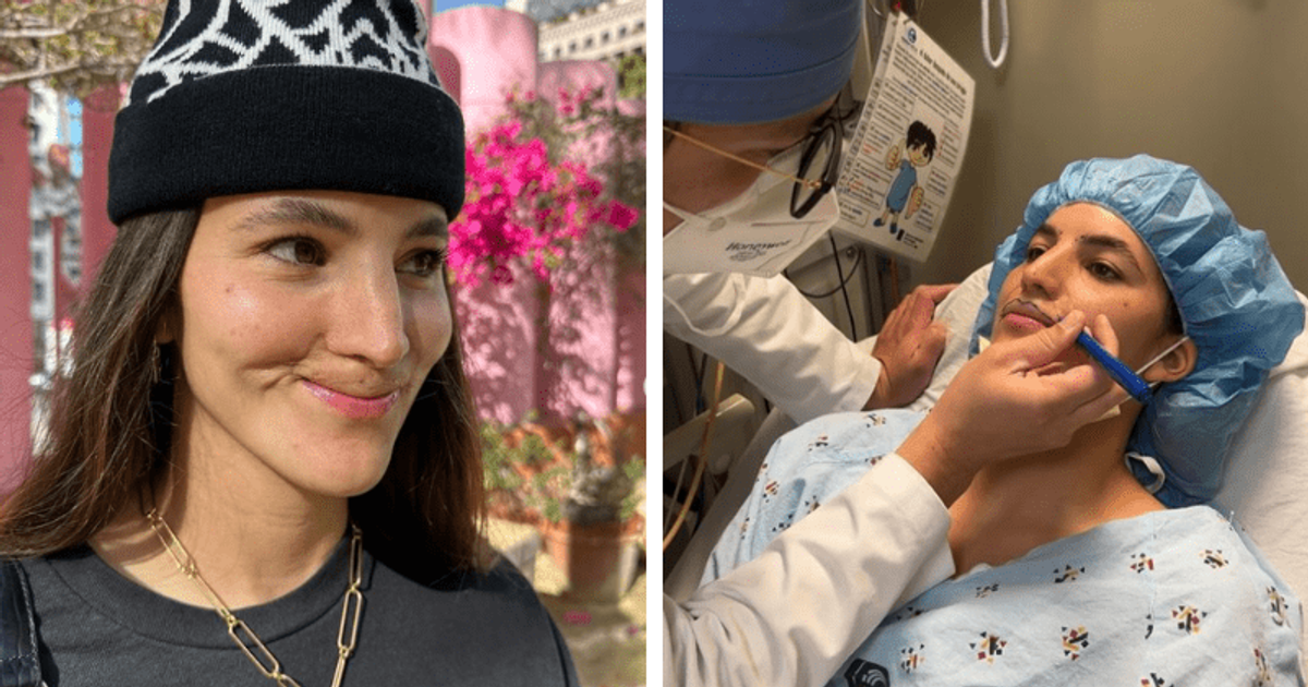 Model Brooklinn Khoury flaunts her brand-new smile after having her upper lip torn off by a pit ...