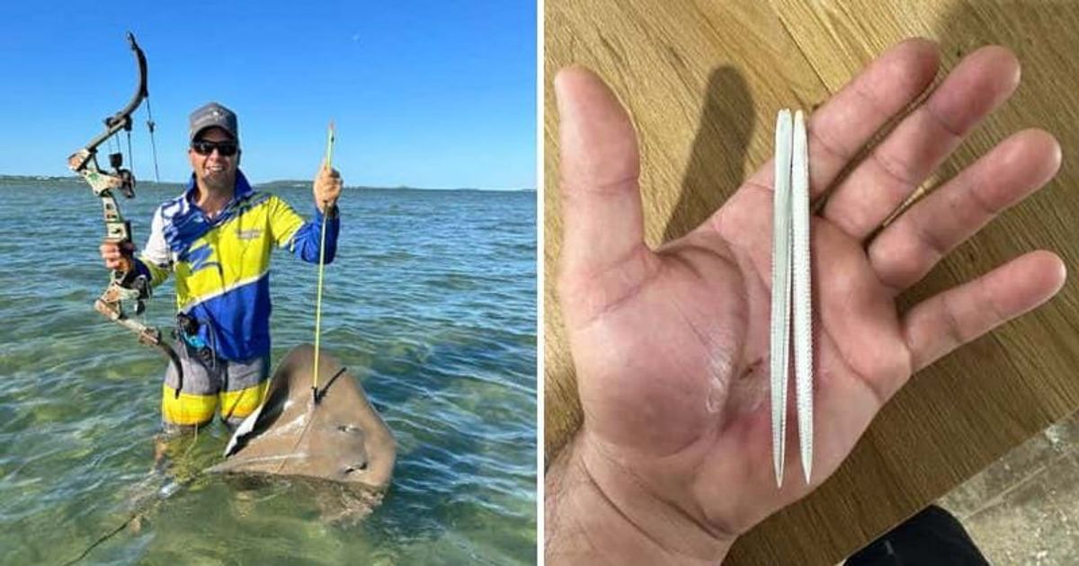 Bow hunter shares awful experience after getting bit by sting ray | MEAWW