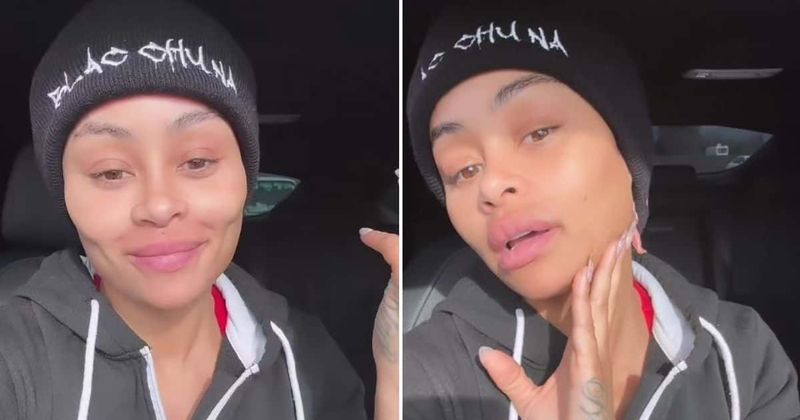 Blac Chyna begins Round 2 of dissolving face fillers with warning | MEAWW