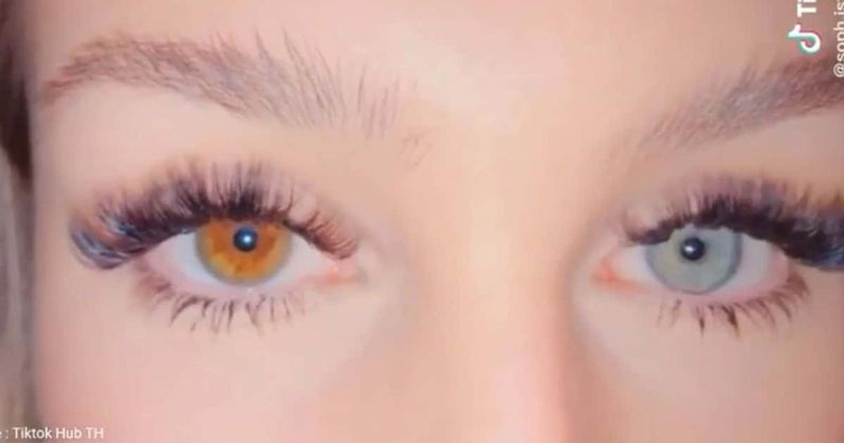 Flashlight In The Eye: Why you should never try this harmful TikTok ...