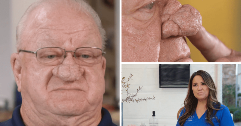 Where is John now? 'Dr Pimple Popper' patient seeks Dr Lee's help to ...