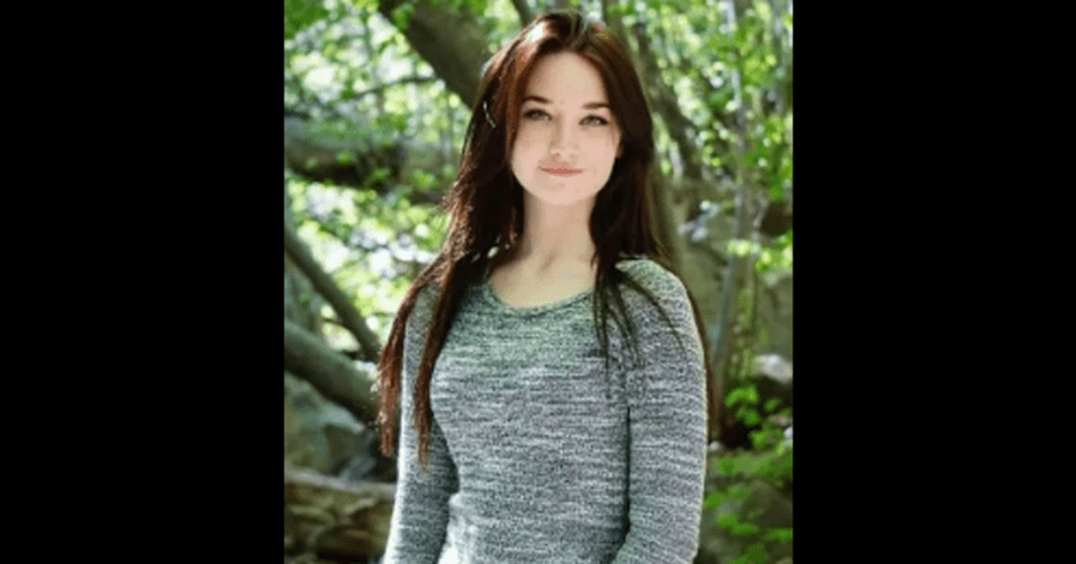 Kayla Nelson: Utah woman, 23, suffers severe burn-like allergic reaction from anxiety medication ...