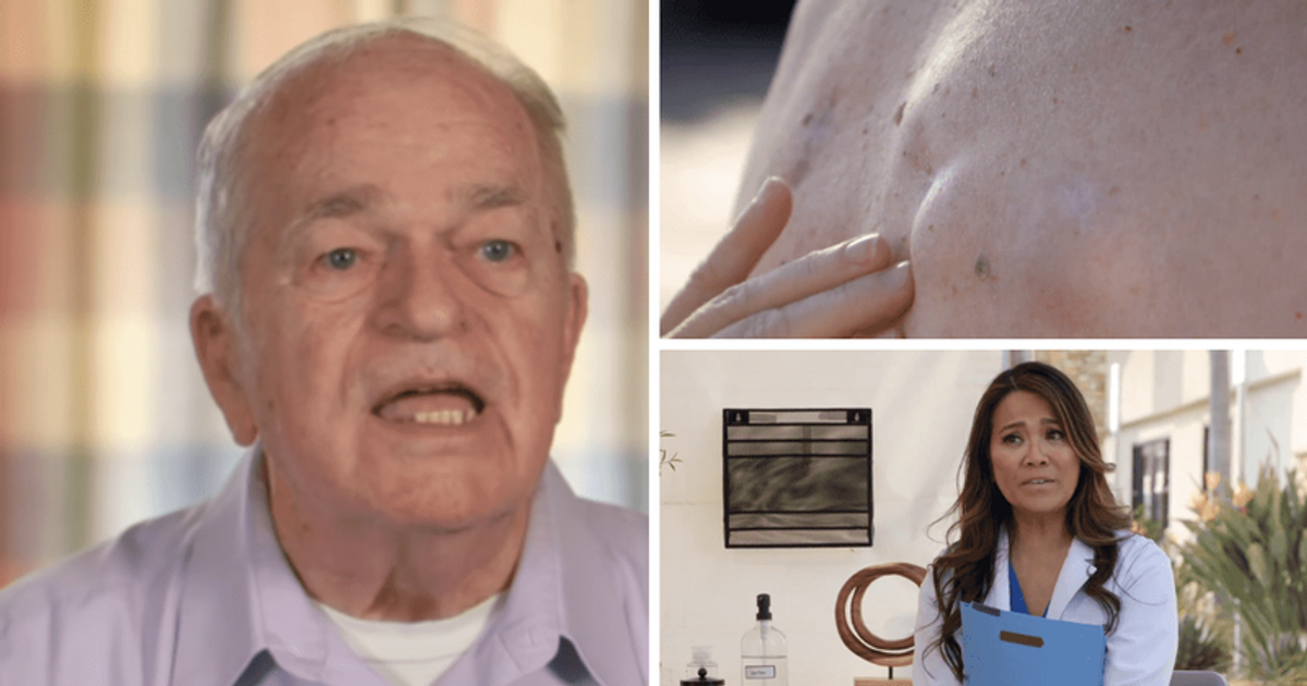 Where is Ralph now? 'Dr Pimple Popper' gives patient who is a 'cyst ...