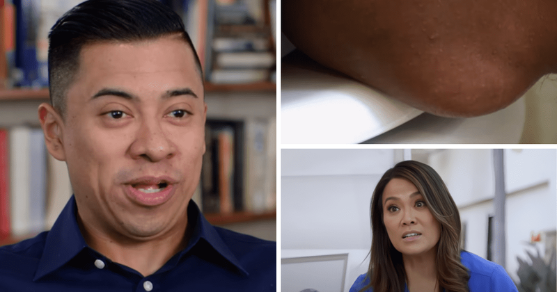 Where Is Keven Now Dr Pimple Popper Patient Wants Butt Lipoma Removed To Get His Tush Back