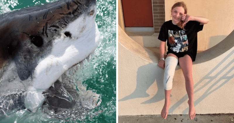 Florida shark attack: Girl miraculously survives shark attack that ...