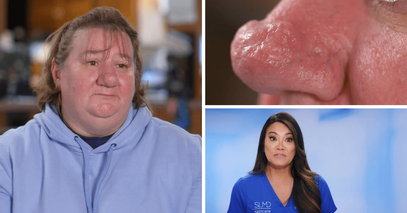 'Dr Pimple Popper' Season 9: Where is Teresa now? Dr Sandra Lee's ...