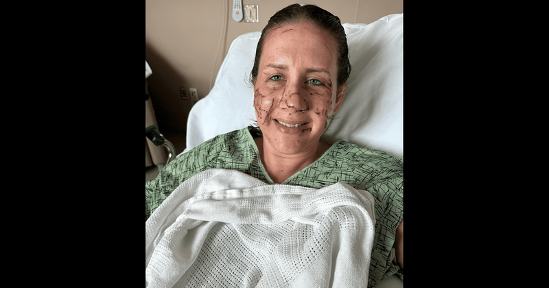 Who is Jen Royce? Montana woman left covered in cuts after being ...