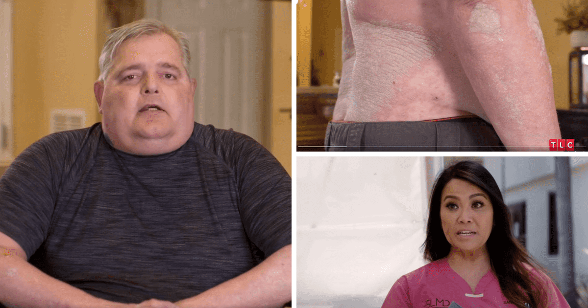 Where is Don now? 'Dr Pimple Popper' helps patient by treating his ...