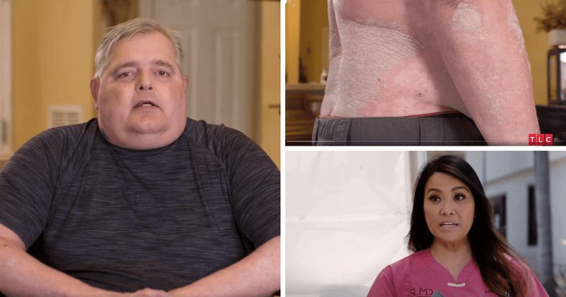 Where is Don now? 'Dr Pimple Popper' helps patient by treating his ...