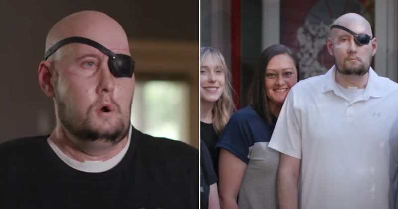 Who is Aaron James? Arkansas military veteran receives world’s first ...